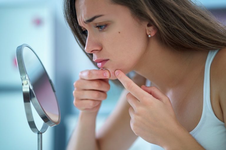 Cystic Acne – What You Need To Know – Skin Research Institute